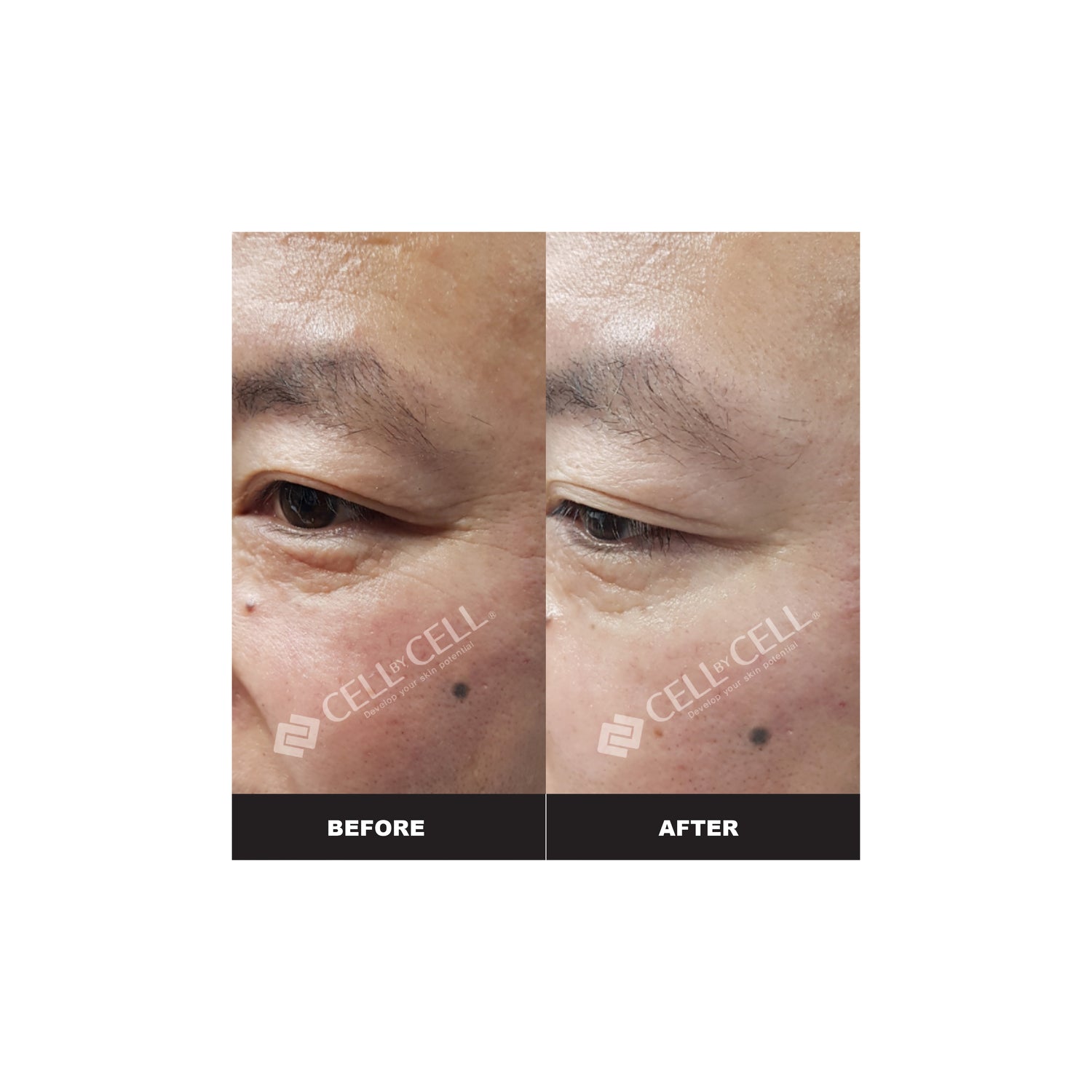 Beautycell LED Device – Cell by Cell